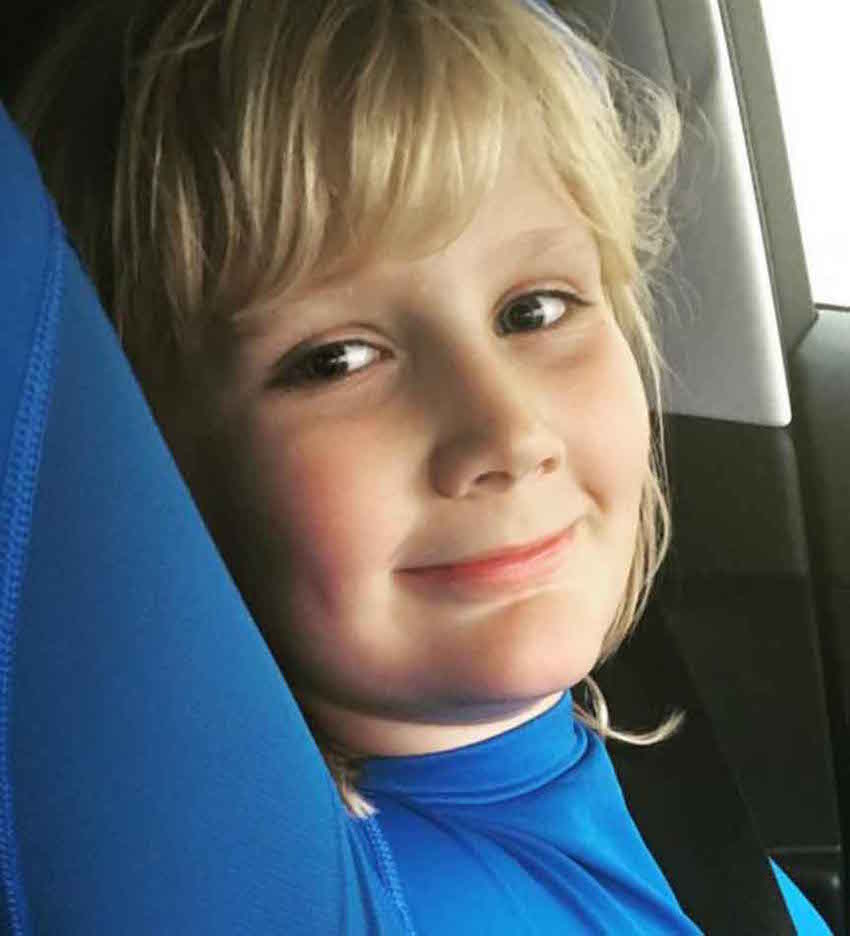 Mom Is So Jealous Of Son's Dimples She Cuts Holes In Her Cheeks, But ...