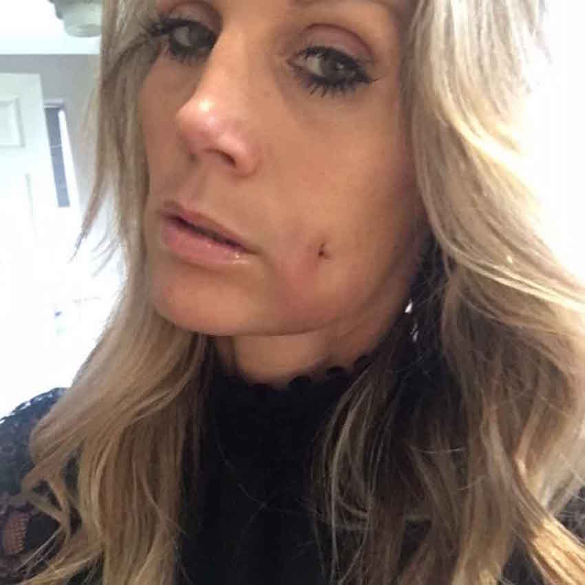 Mom Is So Jealous Of Son's Dimples She Cuts Holes In Her Cheeks, But ...