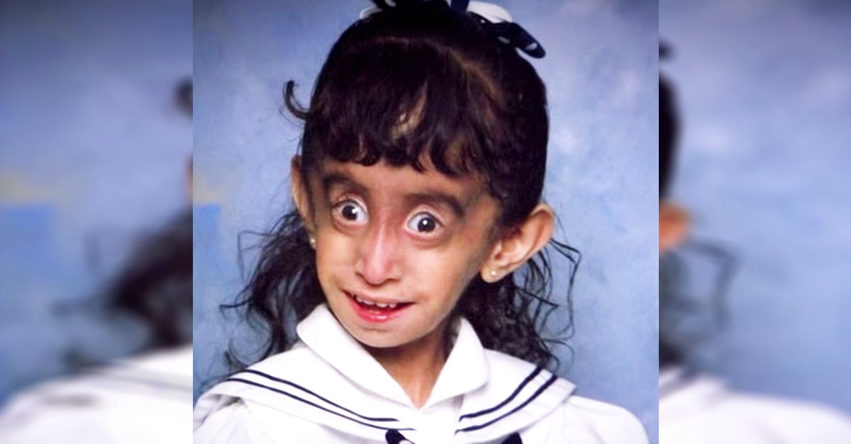 Bullies Call Her The ''World's Ugliest Woman.'' After Years Of Hiding ...