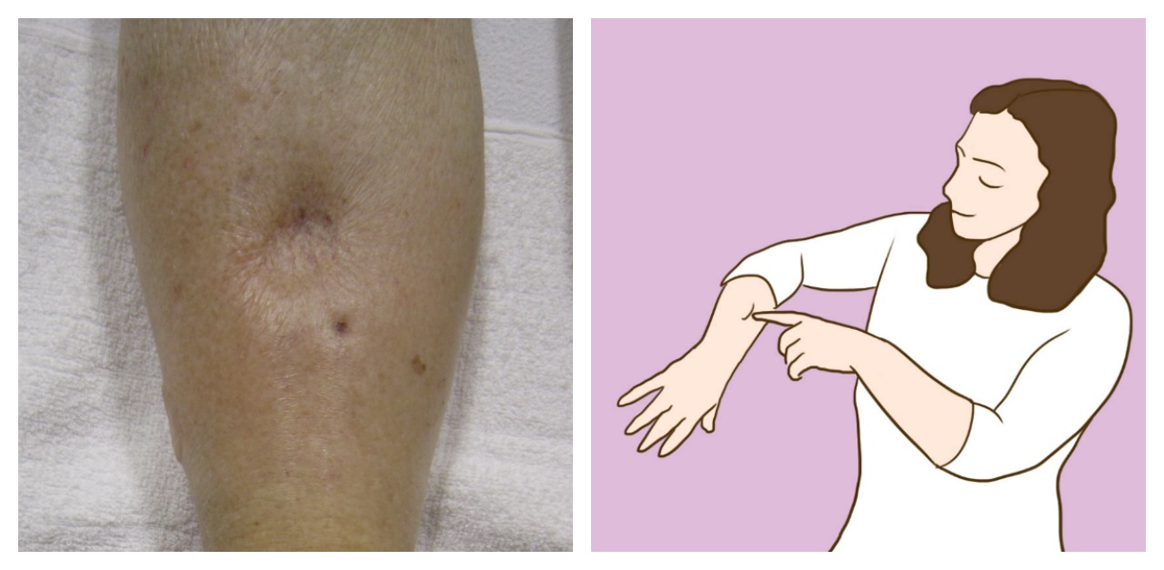 Pressing Your Skin To Test Your Water Retention