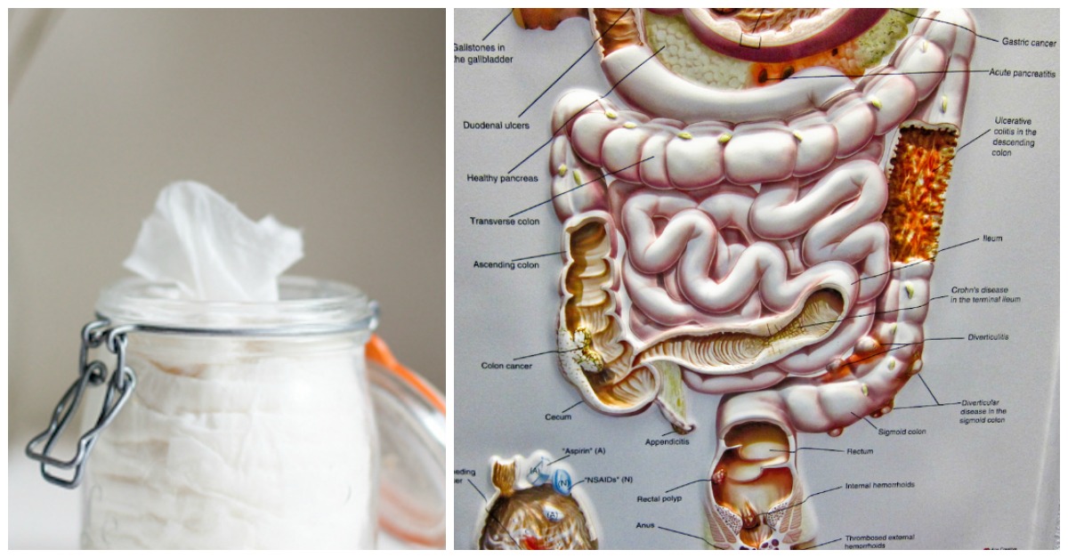 Colonoscopy Prep: Tips You Need To Know Before Procedure