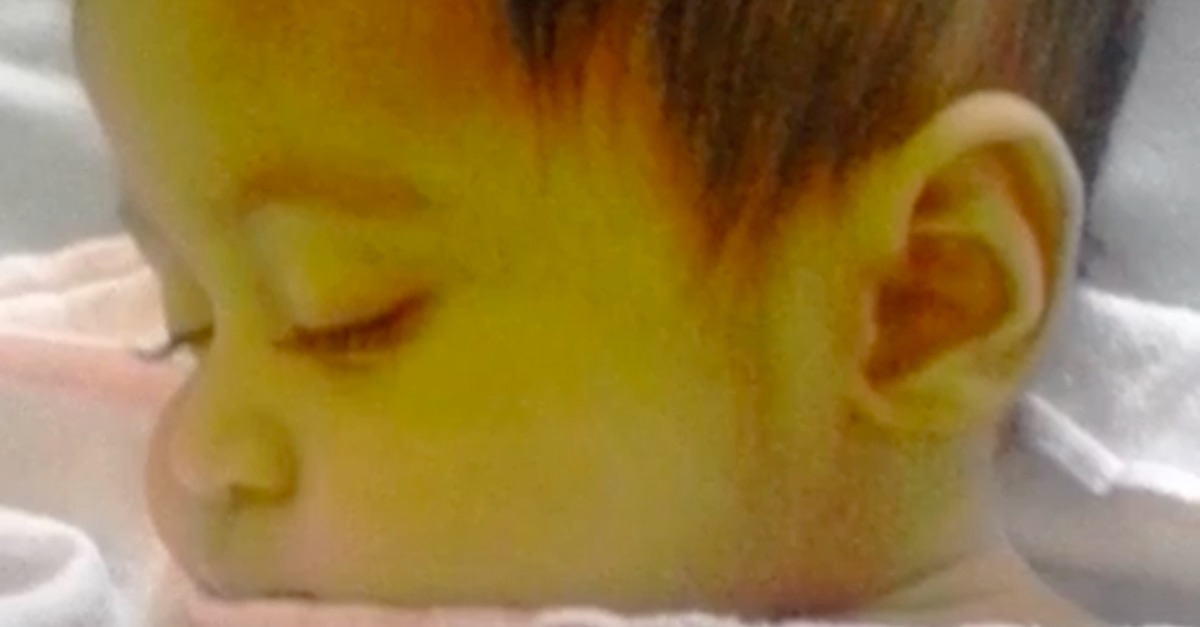 Mom Thinks Newborn Has Jaundice, Then Her Skin Becomes So Yellow She’s ...