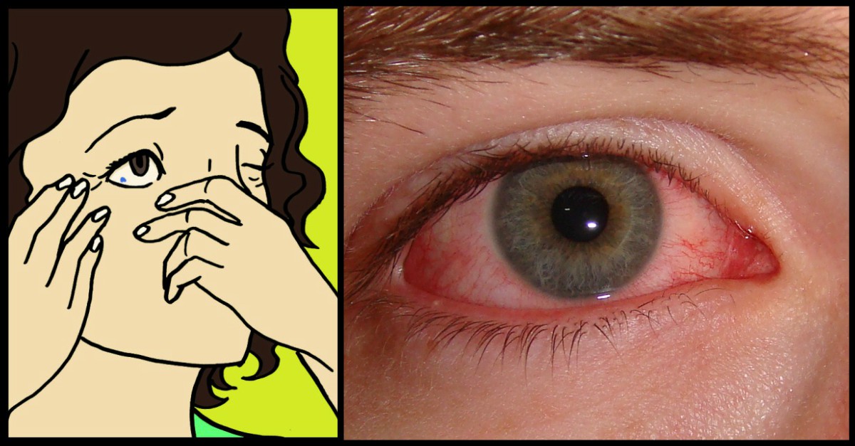 10 Alarming Health Red Flags From Your Eyes