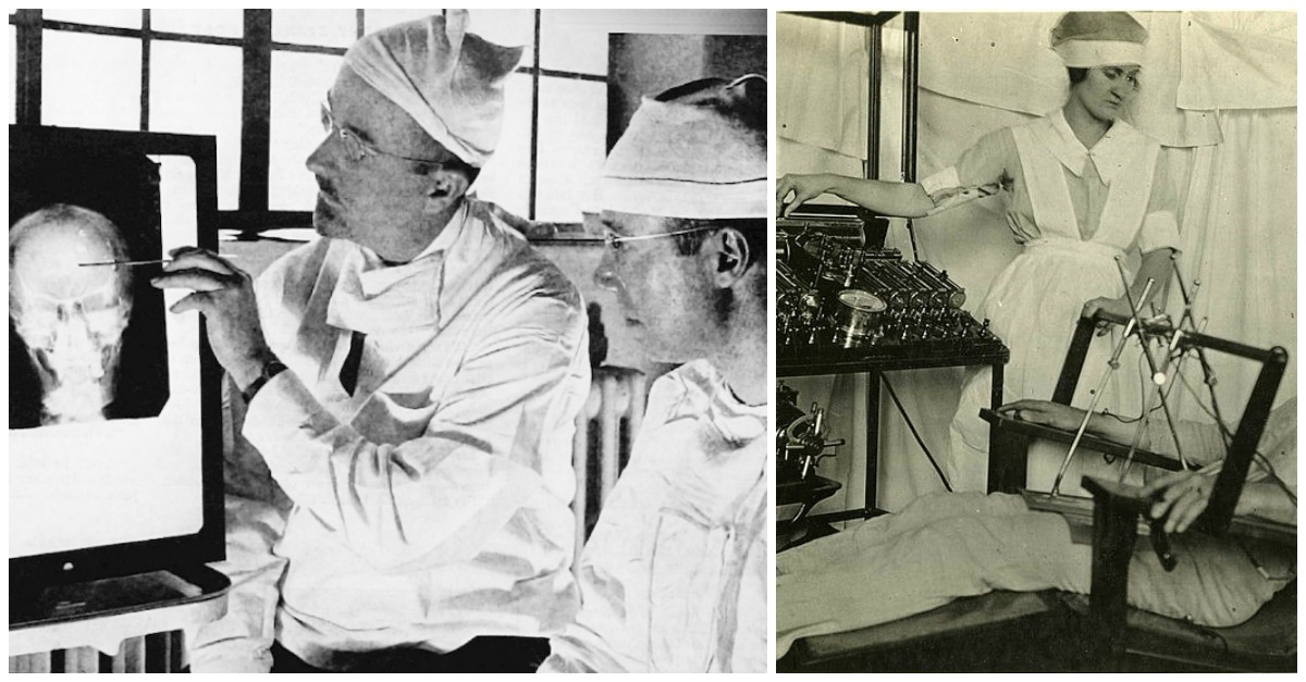 Vintage Therapy Methods Doctors Used Back In The Day