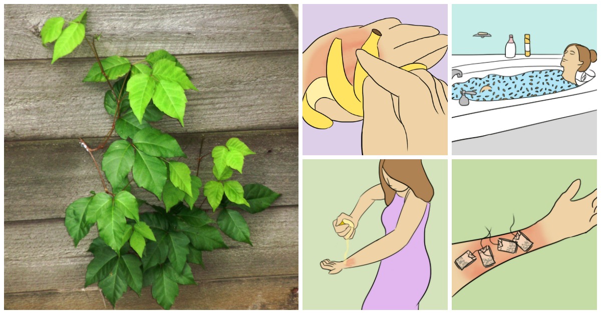 Home Remedies For Poison Ivy For Itchy Rashes