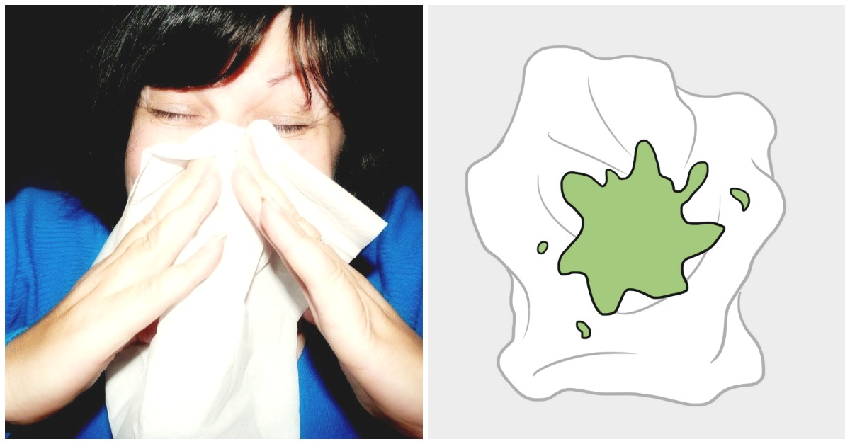 Mucus Color Meaning: 7 Different Colors You Need to Know