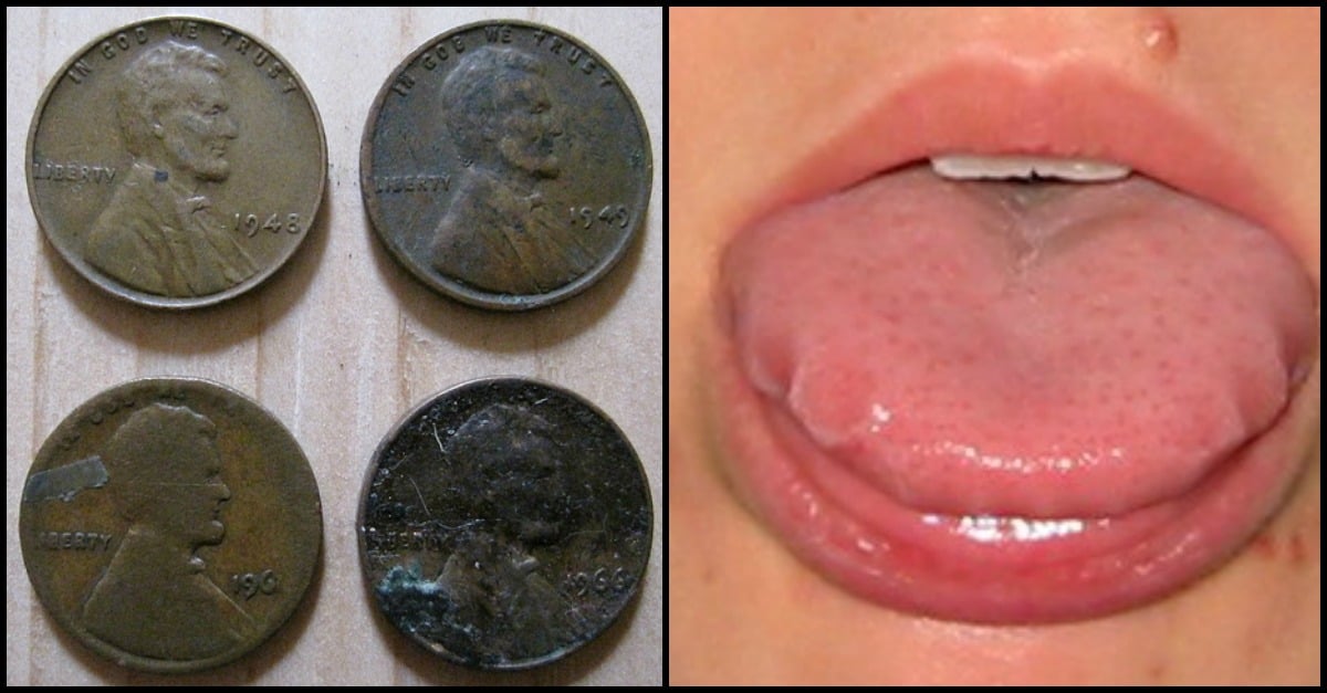Why Do I Have A Metallic Taste In My Mouth?