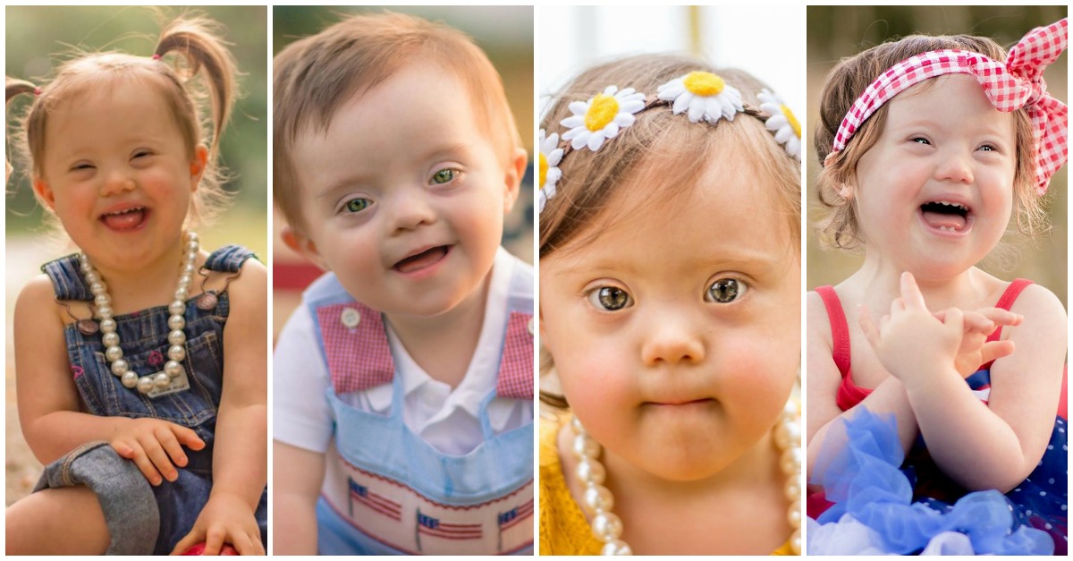 Photographer Captures The Beauty Of Special-Needs Children In A ...