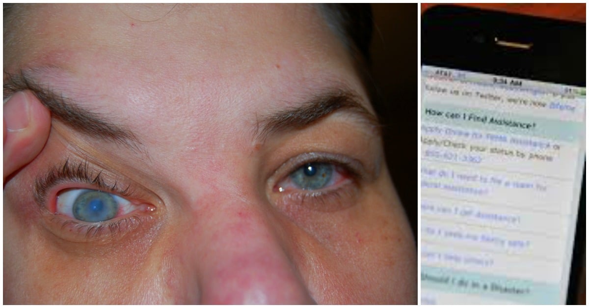 Screen Fatigue: 7 Dangerous Symptoms To Look Out For