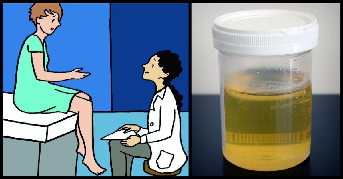 Stinky Pee: 7 Reasons Your Urine Smells Weird