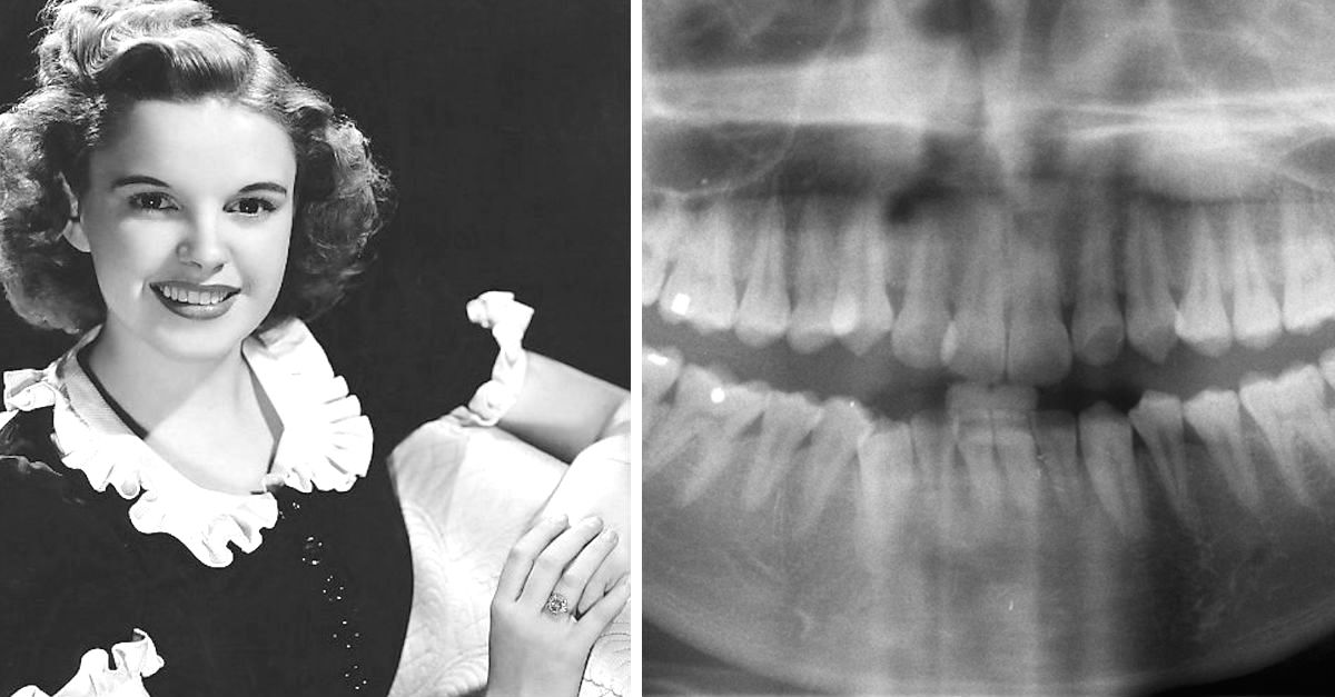 Tragic Hollywood Starlets: 11 Leading Ladies Who Hid Their Secret Past