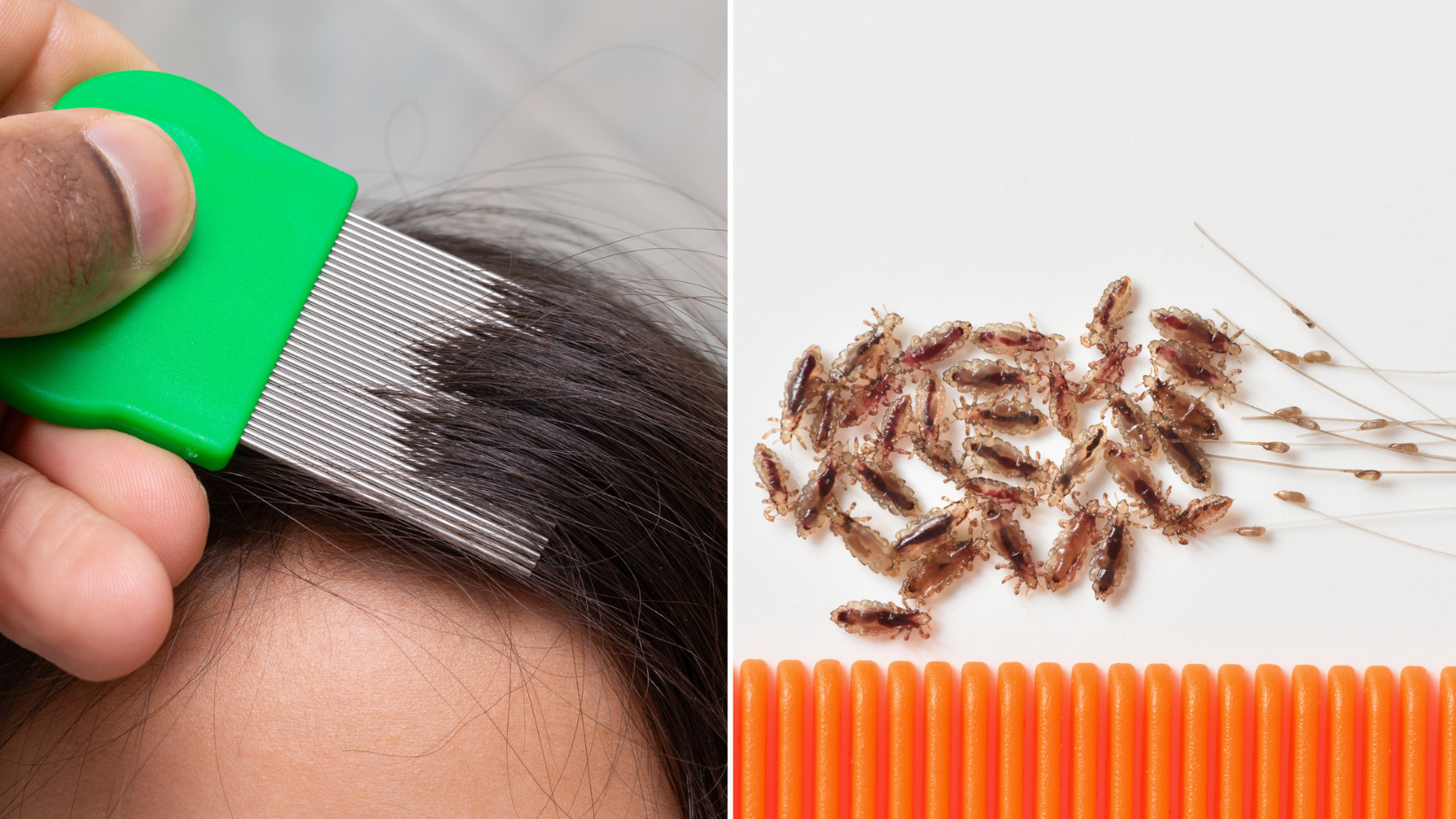 Head Lice Experts Report Cases Of Head Lice Are Increasing