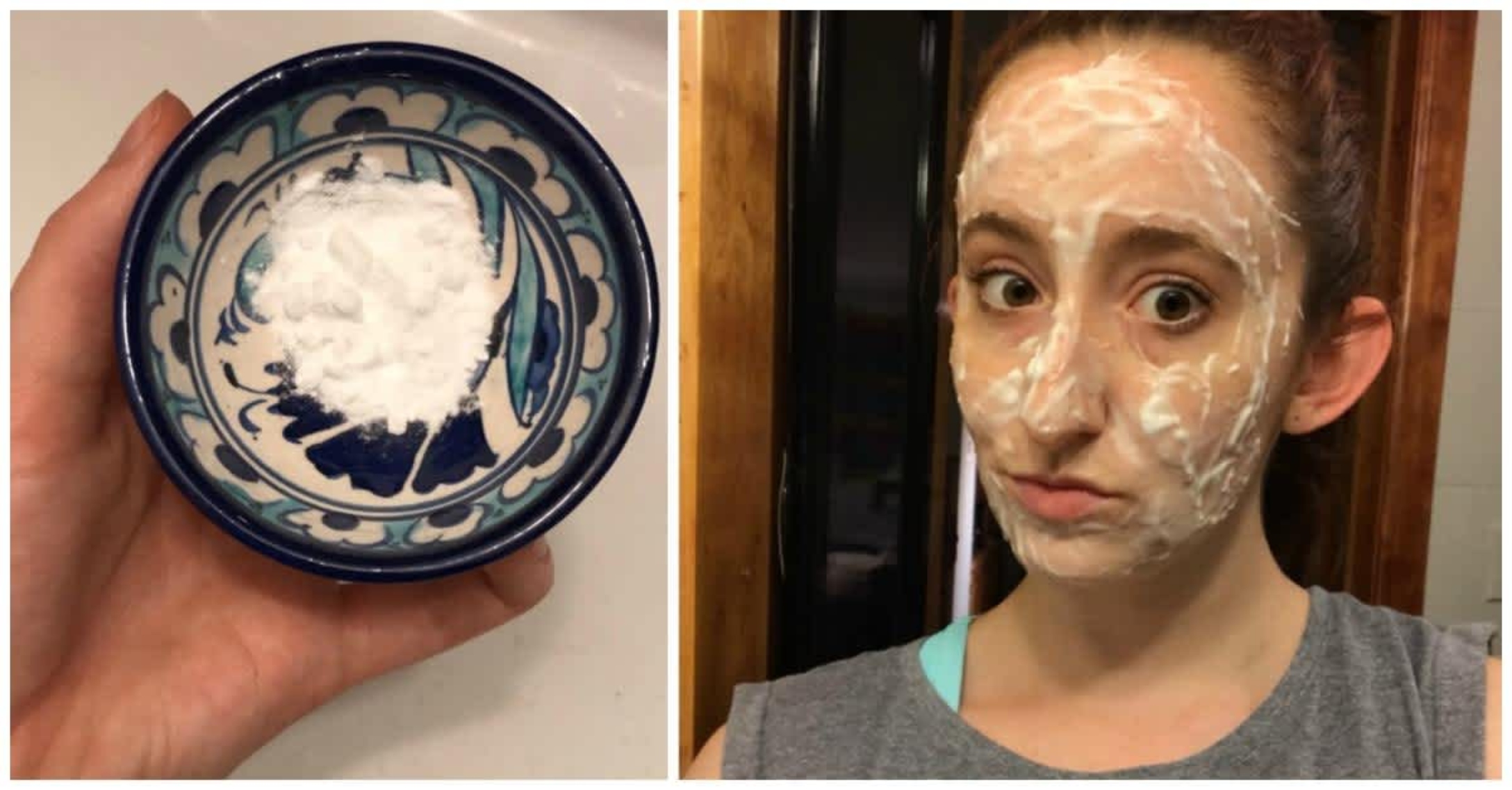 I Used Baking Soda Face Wash To Cleanse My Skin