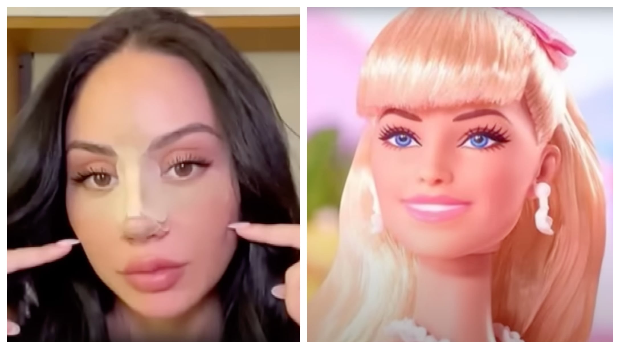 Woman Gets Cosmetic Surgery To Get Barbie-Inspired Nose