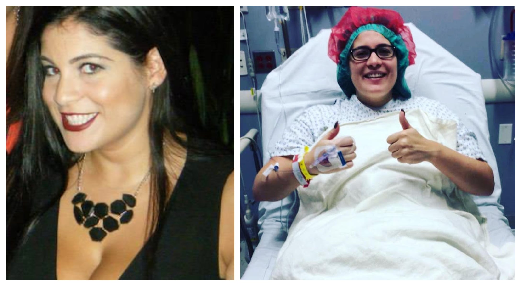 I Got Breast Reduction Surgery. 10 Things I Wish I’d Known