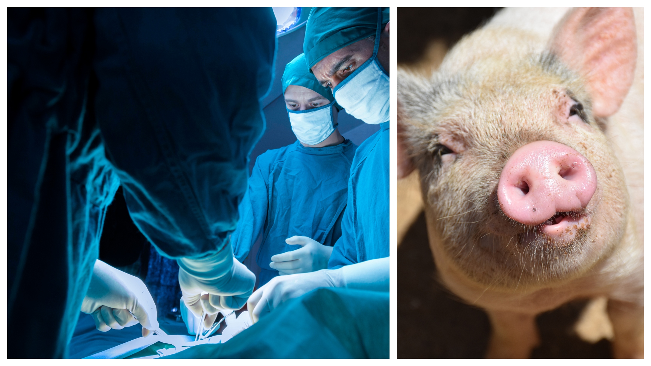 Pig Kidney Transplanted Into Brain-Dead Human In Miracle Procedure