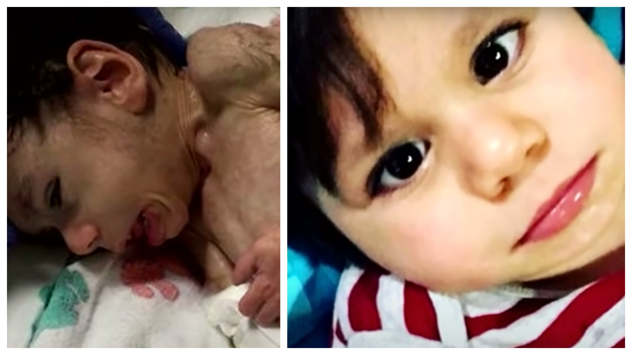 A Starving 8-Year-Old Orphan’s Astonishing Rescue And Transformation