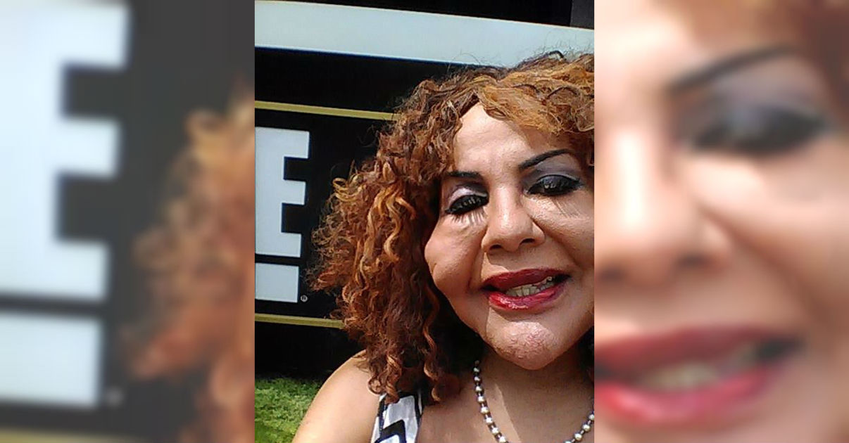 Evil 'Doctor' Pumps Her Face Full Of Cement. 11 Years Later, She's ...