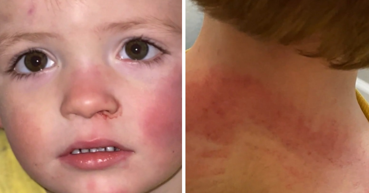 A Mom Speaks Up About The Danger Of Peloton Treadmills After Her ...